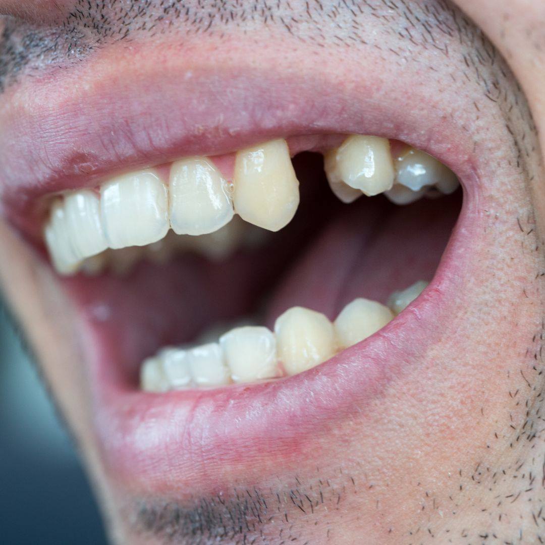 My teeth are terrible!! Help! - Aesthetic Dentistry